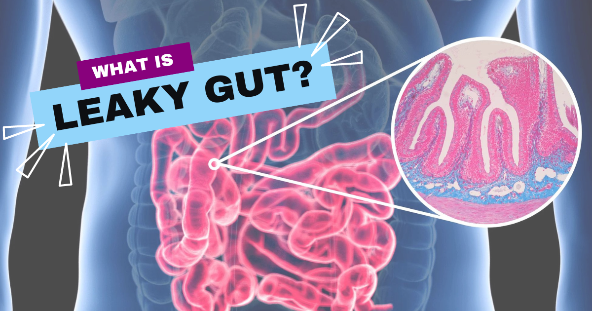 What is Leaky Gut? – Save My Gut